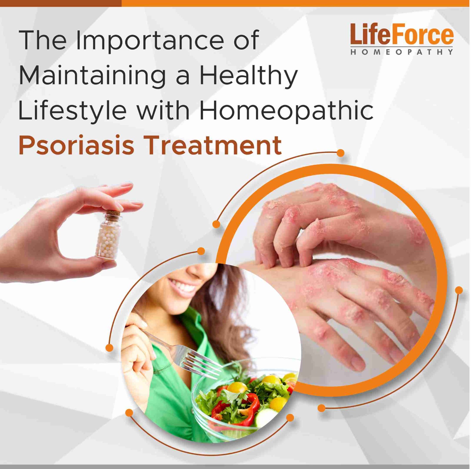 Homeopathic Psoriasis Treatment: Maintain a Healthy Lifestyle
