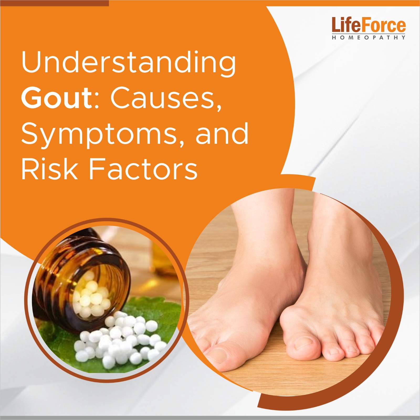 Gout Causes and Signs Blog | Simplified Insights
