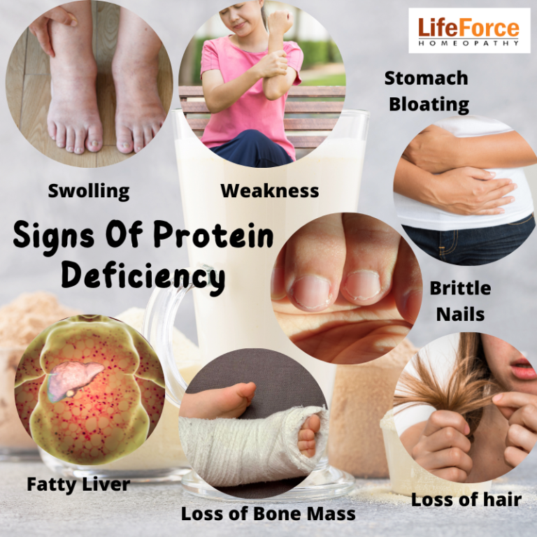 12 Surprising Signs Of Protein Deficiency