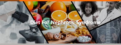 Diet For Nephrotic Syndrome Patients To Follow