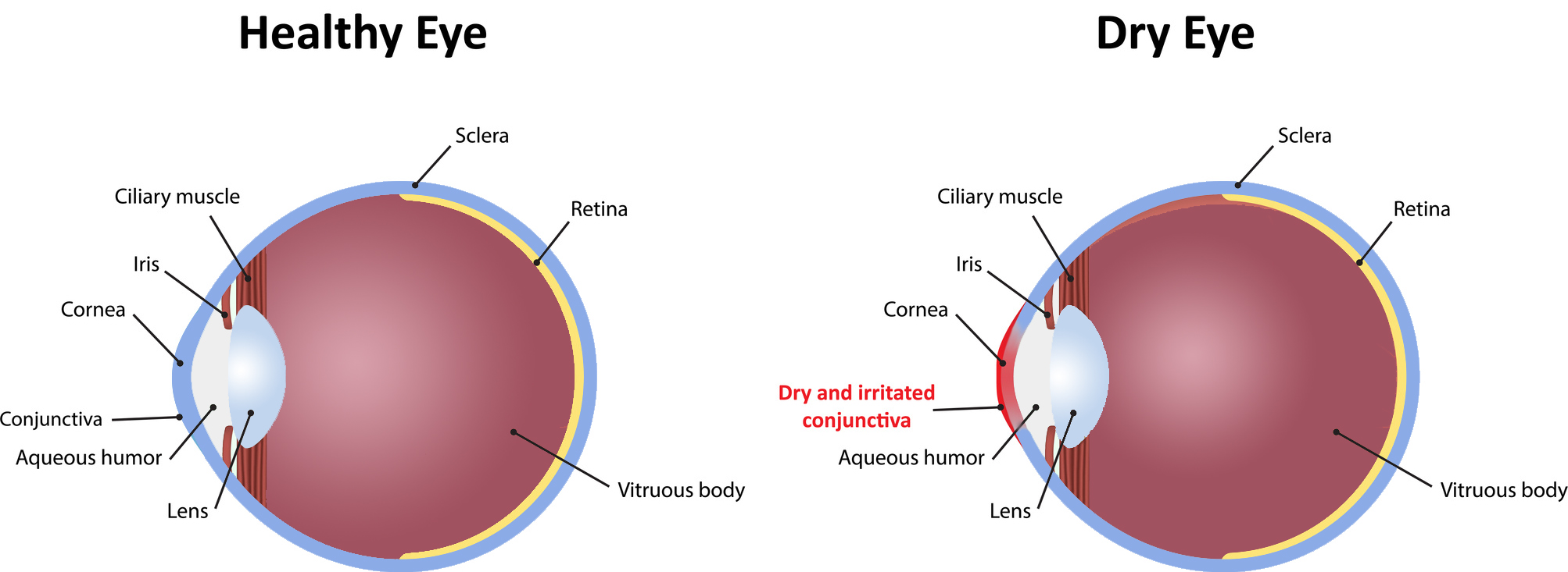 Is Your Eye Makeup Giving You Dry Eyes Lifeforce is-your-eye-makeup-giving-you-dry-eyes-lifeforce